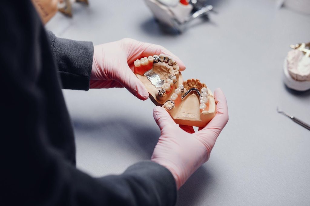 Understanding Partial Dentures: Cost, Types & Key Factors